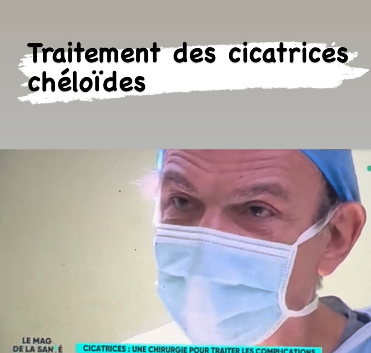 Les cicatrices chéloïdes – Professeur Maurice Mimoun